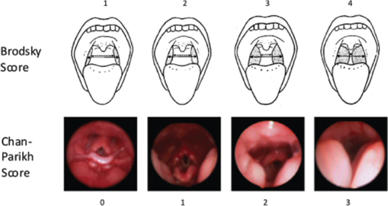 Comparison of Brodsky physical exam score and representative images of ...